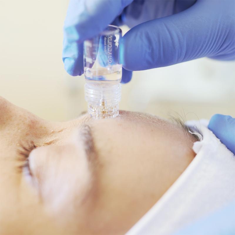 Skin Needling with Dermal Stamp | Online – Skin & Beauty Training Centre